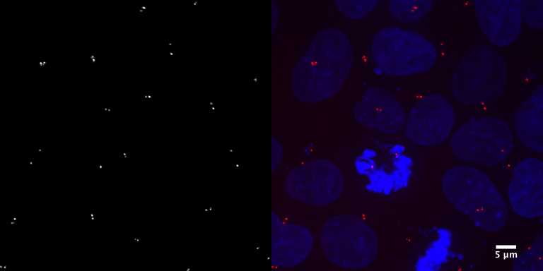 Allen Cell Collection