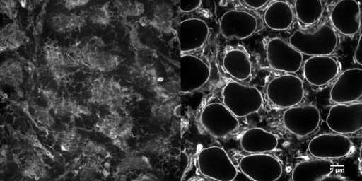 Allen Cell Collection