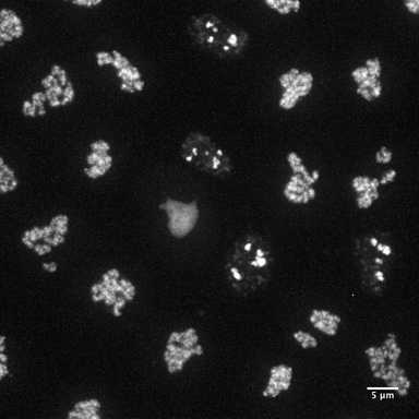Allen Cell Collection