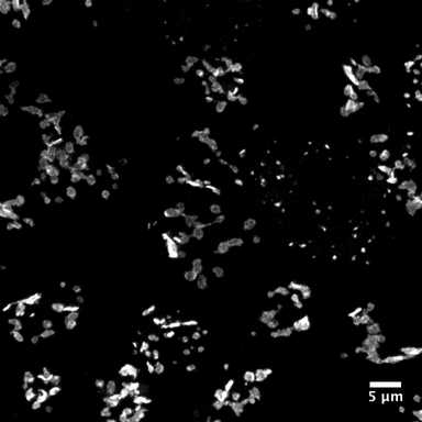 Allen Cell Collection